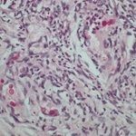 Cryptococcus - Altmeyers Enzyklopädie - Fachbereich Mikrobiologie