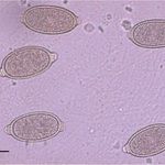 Capillaria - Altmeyers Encyclopedia - Department Microbiology