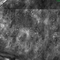 Lentigo simplex Bilder - Altmeyers Enzyklopädie - Fachbereich Dermatologie