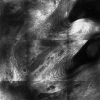 Keratoakanthom (Übersicht) Bilder - Altmeyers Enzyklopädie - Fachbereich Dermatologie