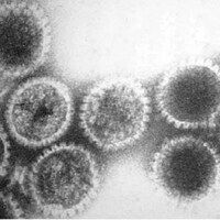 Herpes simplex virus Images - Altmeyers Encyclopedia - Department ...