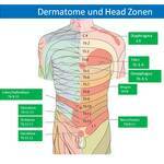 Headsche Zonen - Altmeyers Enzyklopädie - Fachbereich Dermatologie