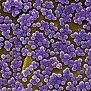 Oil beetle dermatitis - Altmeyers Encyclopedia - Department Dermatology