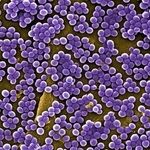 LA-MRSA in pigs - Altmeyers Encyclopedia - Department Internal medicine