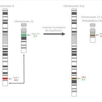 Philadelphia-Chromosom Bilder - Altmeyers Enzyklopädie - Fachbereich ...