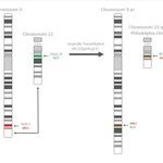 ABL1 Gene - Altmeyers Encyclopedia - Department Internal medicine