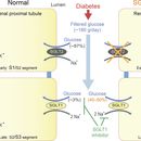 Hobnail endothelials - Altmeyers Encyclopedia - Department Dermatology