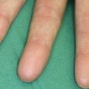 Trace elements, deficiency symptoms - Altmeyers Encyclopedia ...