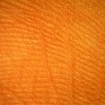 Ridged skin - Altmeyers Encyclopedia - Department Dermatology