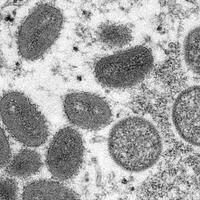 Affenpocken Bilder - Altmeyers Enzyklopädie - Fachbereich Dermatologie
