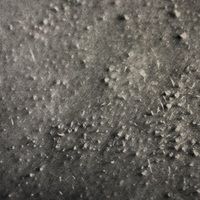 Lichen spinulosus Images - Altmeyers Encyclopedia - Department Dermatology