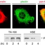 Plectin - Altmeyers Encyclopedia - Department Dermatology
