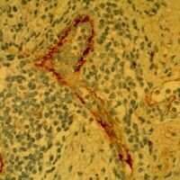 Capillary Images - Altmeyers Encyclopedia - Department Dermatology