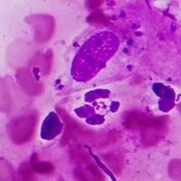 Erysipeloid Cutaneous Leishmaniasis Images - Altmeyers Encyclopedia ...