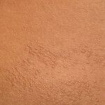 Granuloma anulare (Übersicht) - Altmeyers Enzyklopädie - Fachbereich ...