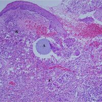 Mycobacterium smegmatis Images - Altmeyers Encyclopedia - Department ...